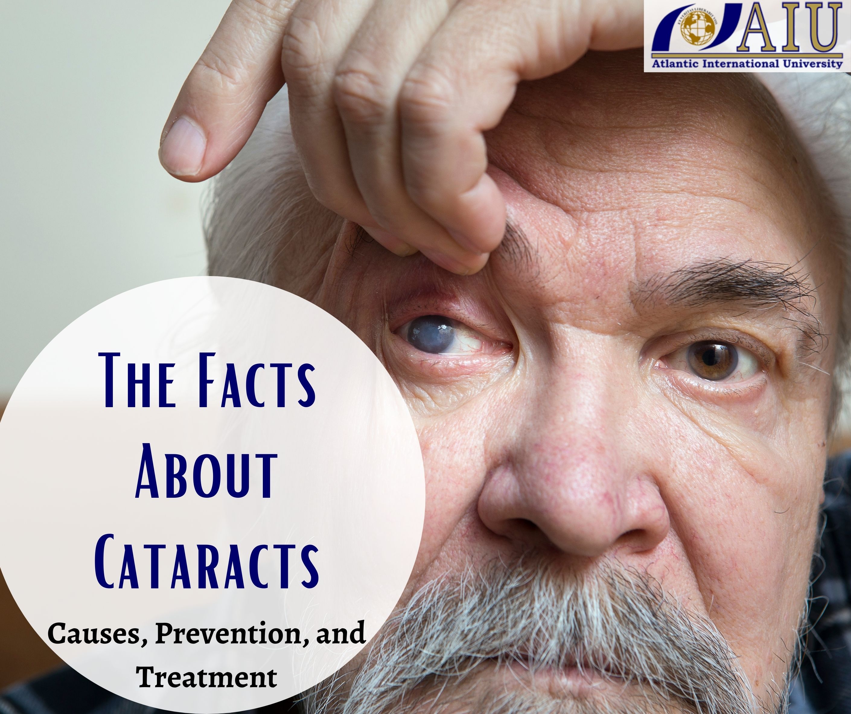 Facts about Cataracts